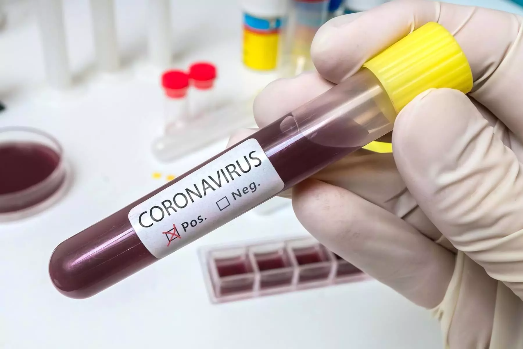Yandex launched a free Coronavirus test for all those who want any age 34323_2